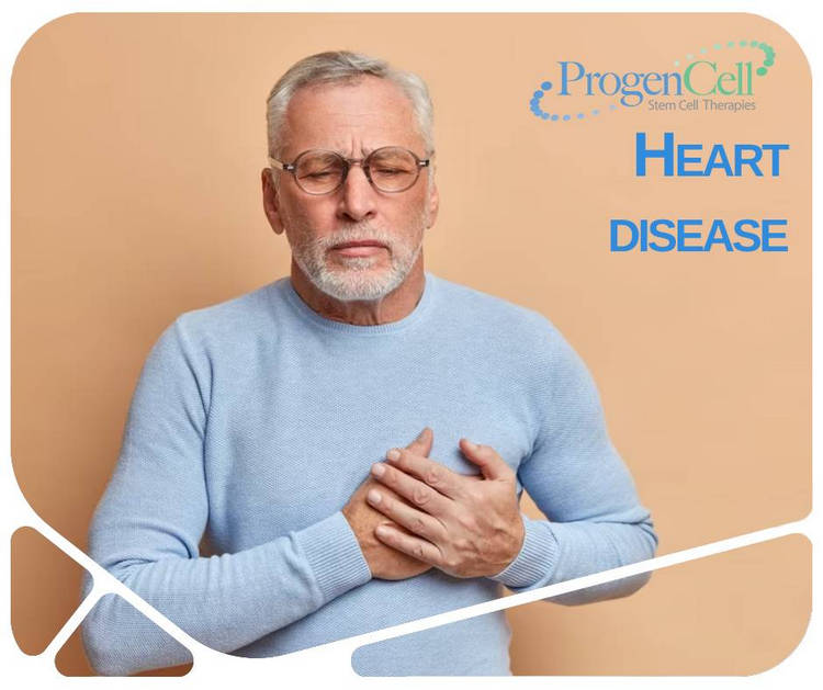 Stem Cell Therapy Heart